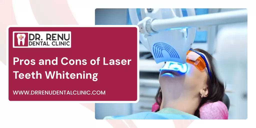 Pros and Cons of Laser Teeth Whitening - Renu Dental