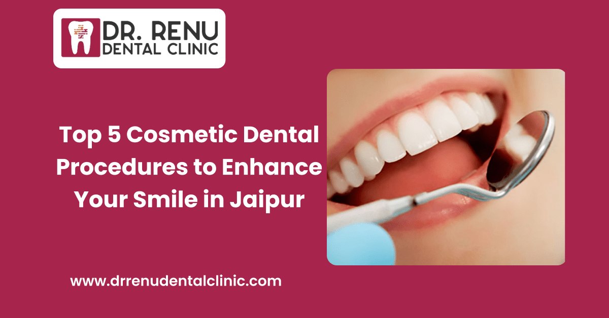 Top 5 Cosmetic Dental Procedures to Enhance Your Smile in Jaipur