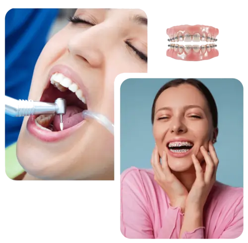 Teeth Straightening in Jaipur at Dr. Renu Dental Clinic